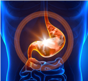 Gastritis causes and prevention & treatment - drharshsheth