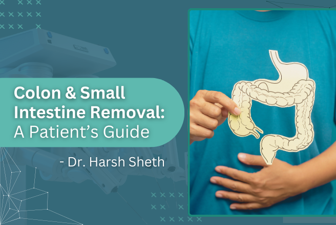 Removal of Colon and Small Intestine | Guided by Dr. Harsh Sheth